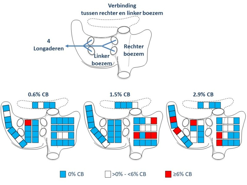 Boezemfibrilleren behandelen met ablatie - Stichting AFIP