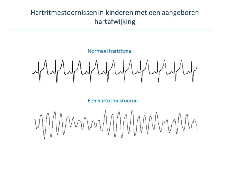 Dieet en patiënt empowerment bij boezemfibrilleren: verbetering ...